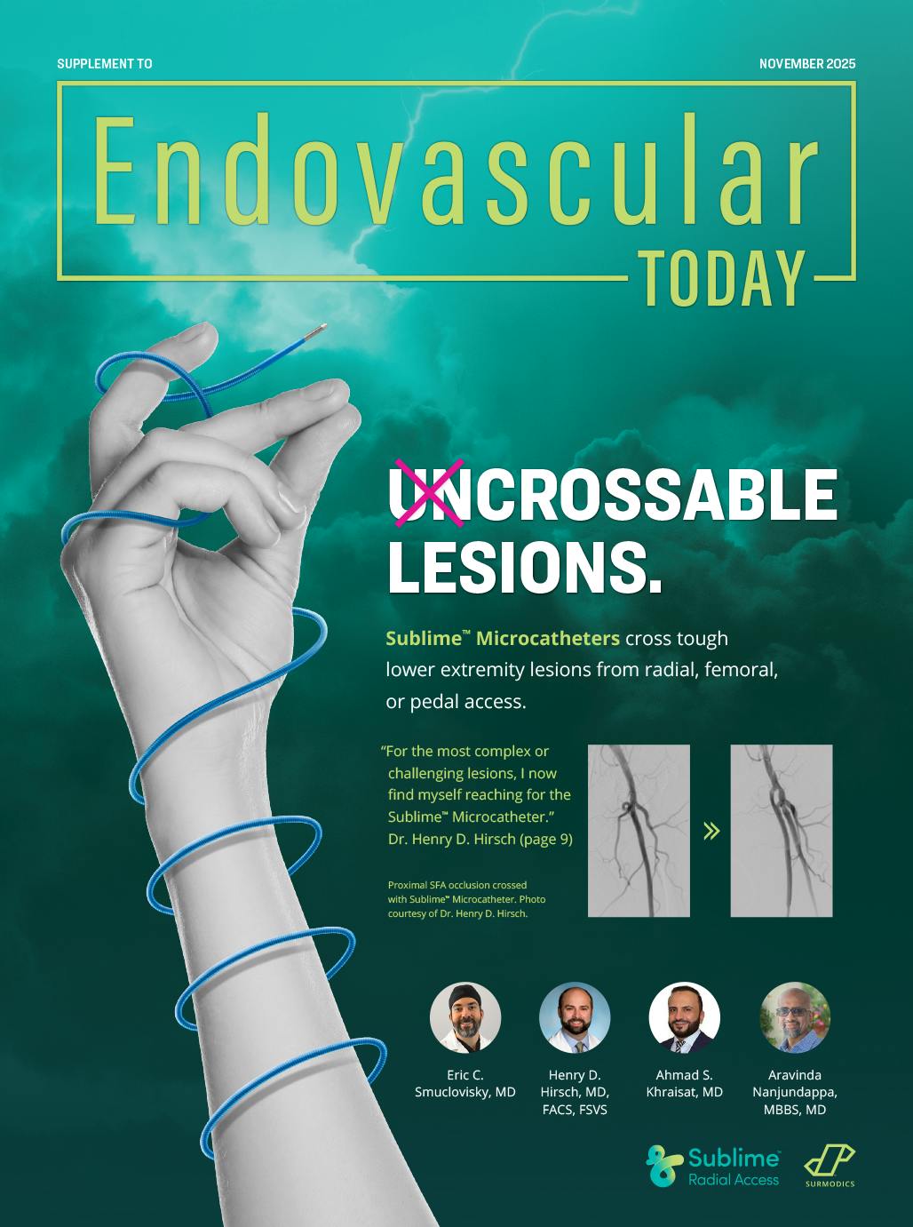 US Device Guide - Endovascular Today